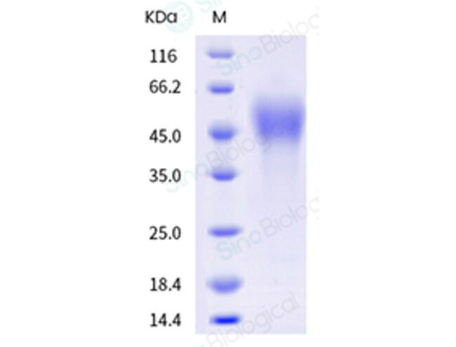 Sino Biological Mouse IL2RA / CD25 Protein (ECD, His Tag) 1mg, Quantity ...