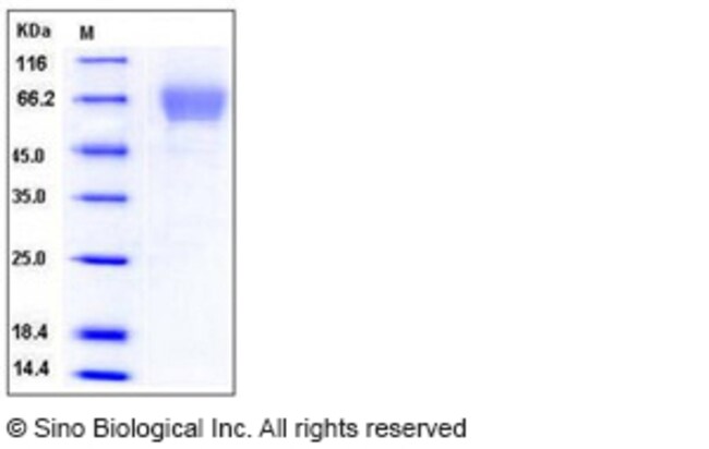 Sino Biological Mouse TIM4 / TIMD4 Protein (His Tag) 1mg, Quantity ...