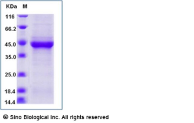 Sino Biological CD3 epsilon/CD3e Protein, Mouse, Recombinant (ECD, hFc ...