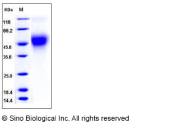 Sino Biological Mouse CD80 / B7-1 / CD28LG Protein (His Tag ...