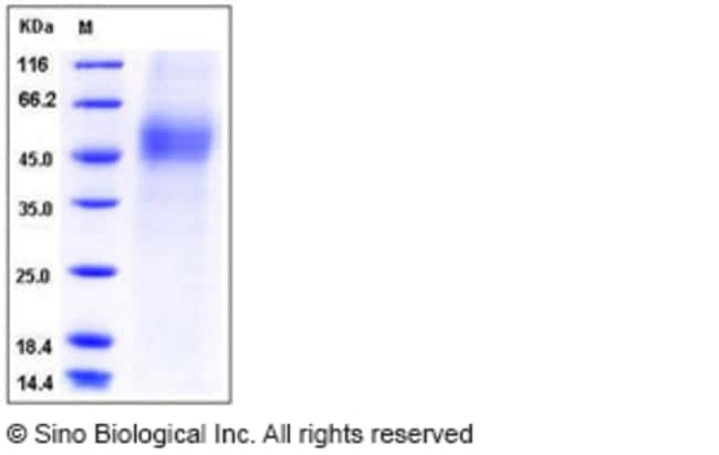 Sino Biological Mouse CD19 / Leu-12 Protein (His Tag) , Biotinylated ...