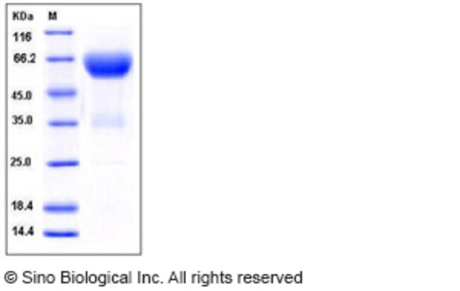 Sino Biological Mouse Ephrin-B2 / EFNB2 Protein (Fc Tag) 100ug ...