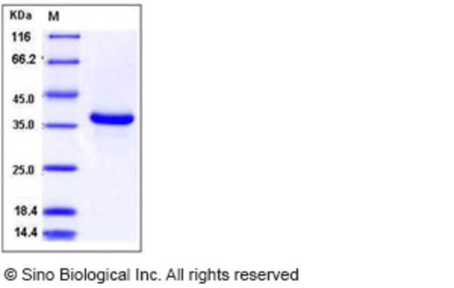 Sino Biological Mouse Epiregulin / EREG Protein (Fc Tag) 1mg, Quantity ...