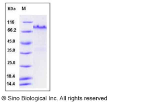 Sino Biological Mouse Notch-1 / NOTCH1 Protein (His Tag) 500ug ...