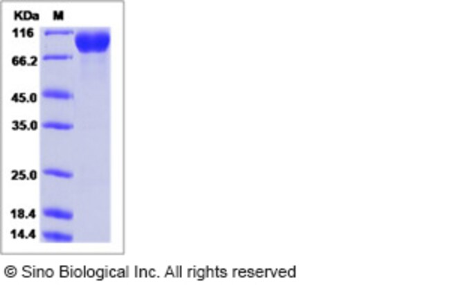 Sino Biological Mouse CD123 / IL3RA Protein (ECD, Fc Tag) 1mg, Quantity ...