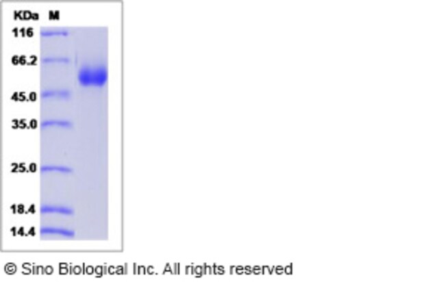 Sino Biological Mouse CD123 / IL3RA Protein (ECD, His Tag) 1mg ...