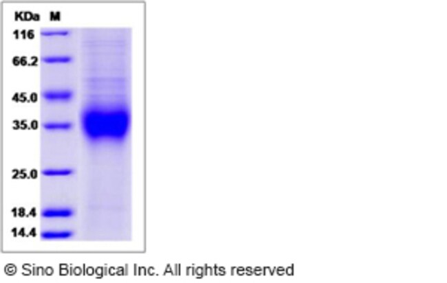 Sino Biological Mouse NKG2A / NKG2 / CD159A / KLRC1 Protein (His Tag ...