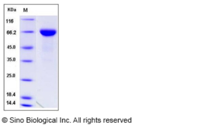 Sino Biological Mouse TROP2 / TACSTD2 Protein (Fc Tag) 1mg, Quantity ...