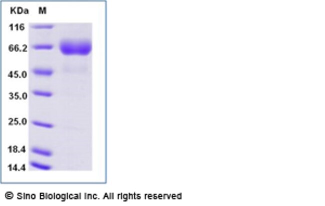 Sino Biological Mouse B7-H3 / CD276 Protein (Fc Tag) 500ug, Quantity ...