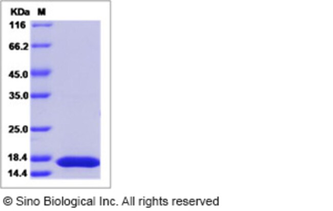 Sino Biological Mouse IL17F / IL-17F Protein 1mg, Quantity: Each of 1 ...