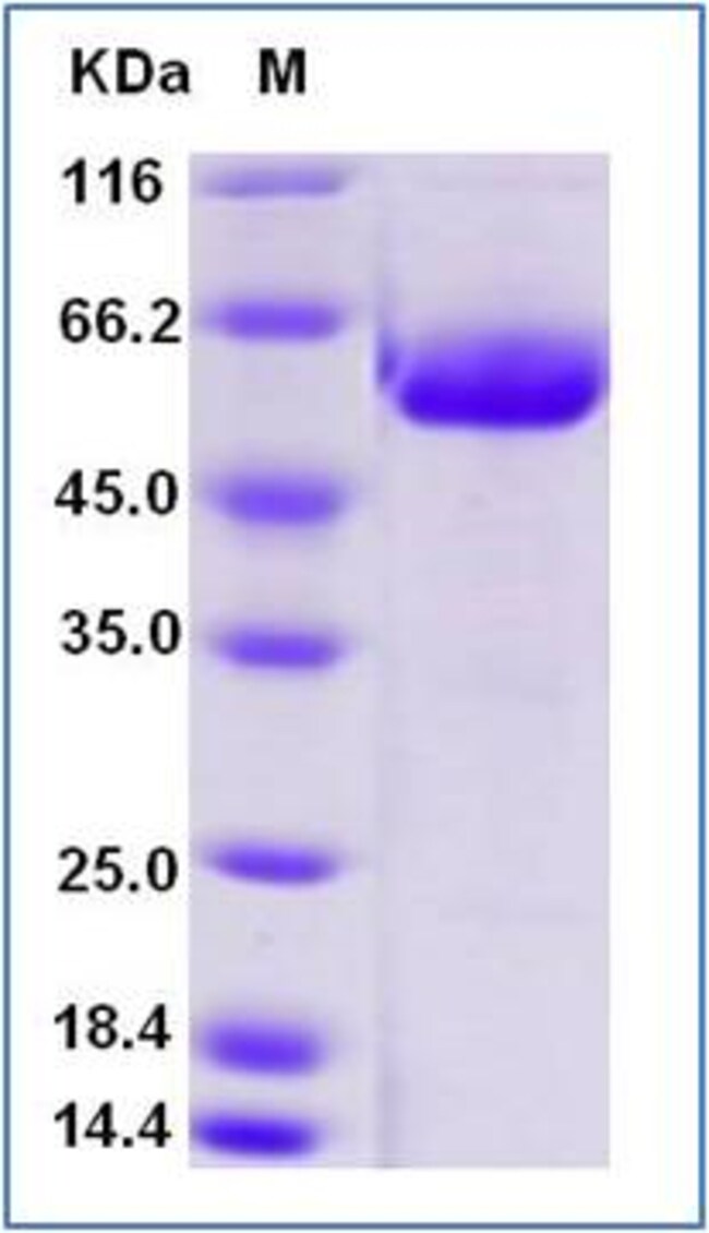 Sino Biological Mouse IL4R Protein (Fc Tag) 100ug, Quantity: Each of 1 ...