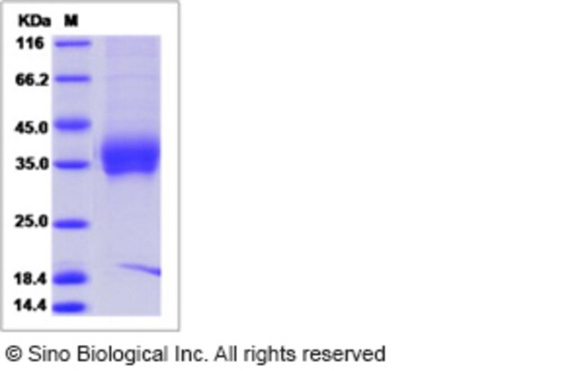 Sino Biological Mouse IL-4R / CD124 Protein (ECD, His Tag) 1mg ...