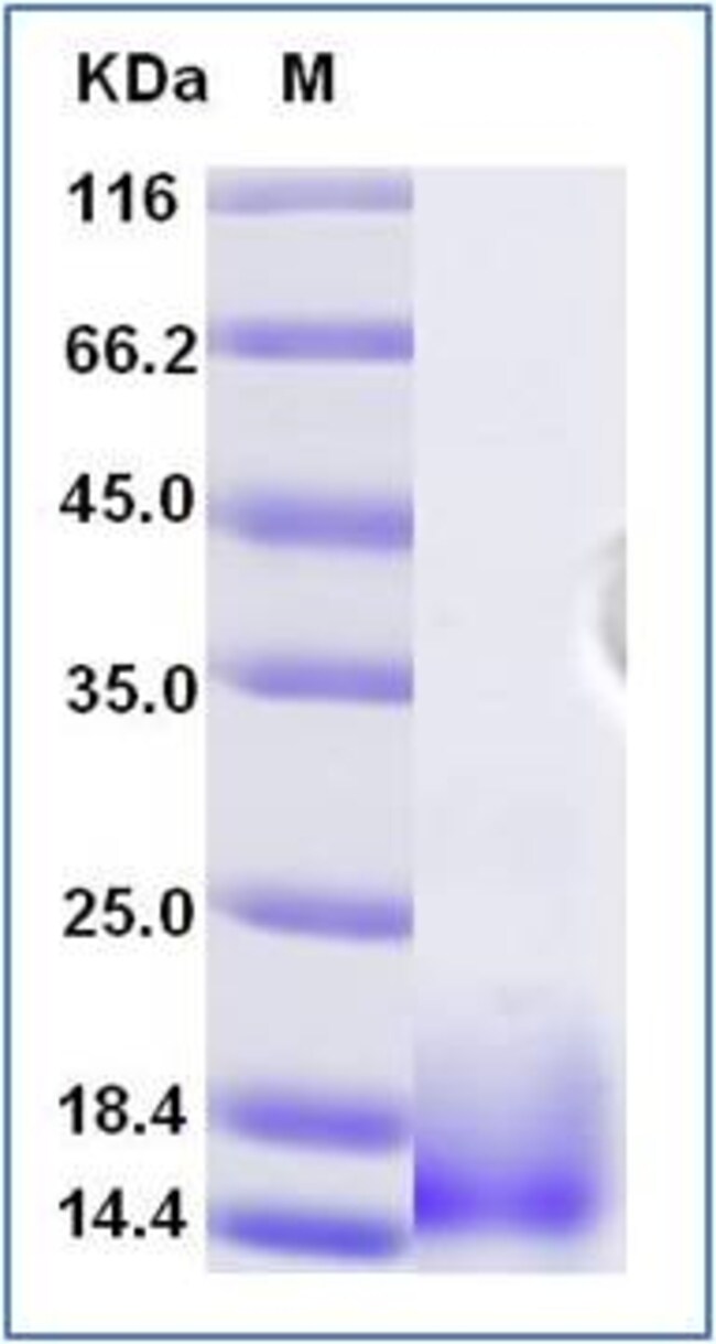 Sino Biological LY6A Protein, Mouse, Recombinant (His Tag) 20µg ...