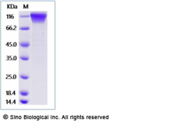 Sino Biological Mouse PDGFRA Protein (ECD, Fc Tag) 1mg, Quantity: Each ...