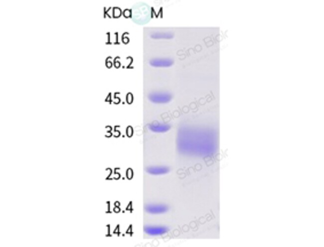 Sino Biological Mouse GITR / TNFRSF18 Protein (ECD, His Tag) 50ug ...