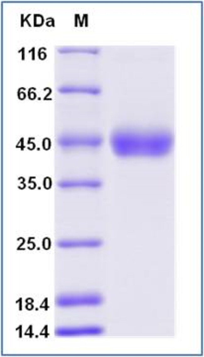 Sino Biological Rabbit CD64 / FCGR1A Protein (His Tag) 100ug, Quantity ...