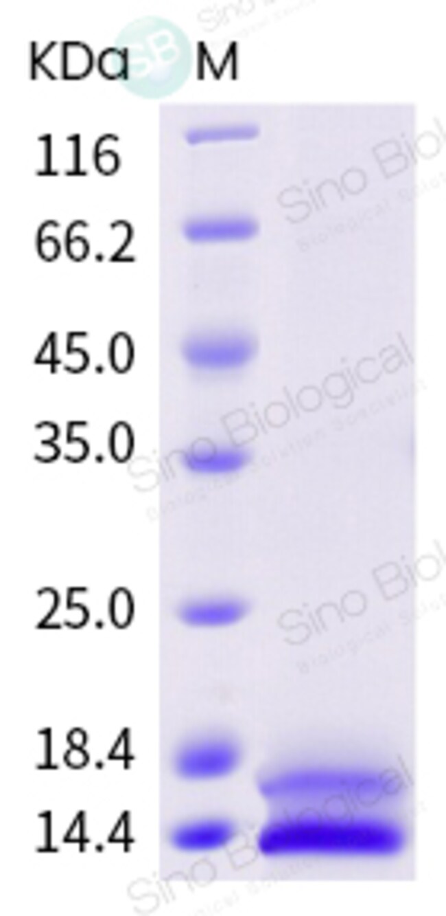 Sino Biological Phleum pratense Phl p 2 Protein (His Tag) 250ug ...