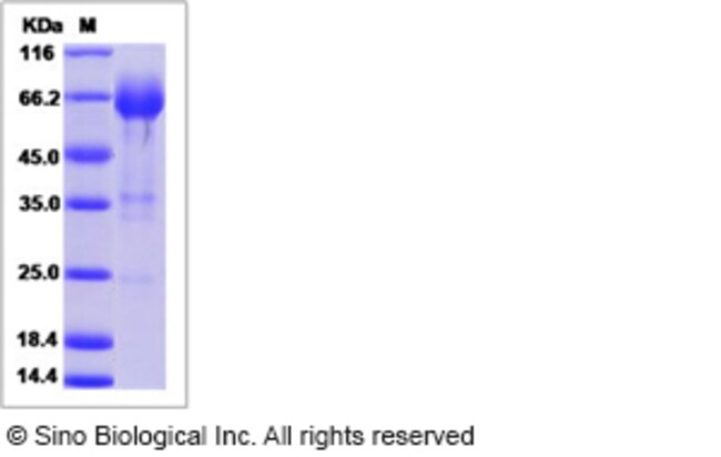 Sino Biological Rat CD32a / Fc gamma RIIA / FCGR2A Protein (ECD, Fc Tag ...