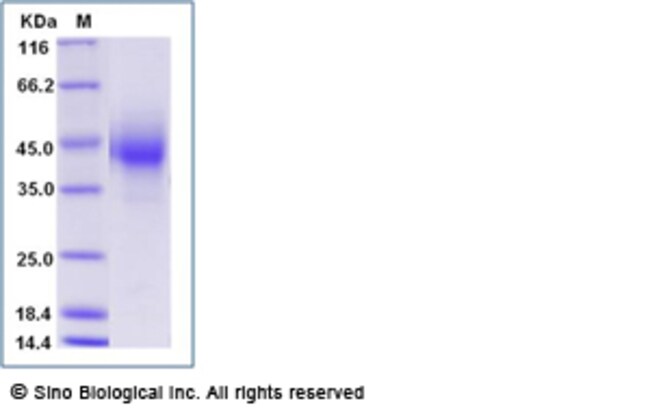 Sino Biological Rat CD32a / Fc gamma RIIA / FCGR2A Protein (His Tag ...