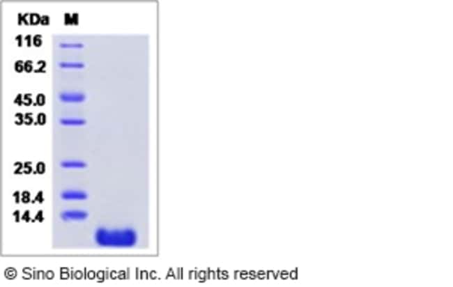 Sino Biological Rat NAP-2 / PPBP / CXCL7 Protein (His Tag) 1mg | Fisher ...