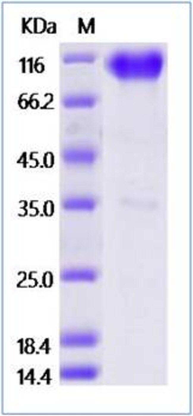 Sino Biological Rat SIRP alpha Protein (ECD, Fc Tag) 200ug, Quantity ...