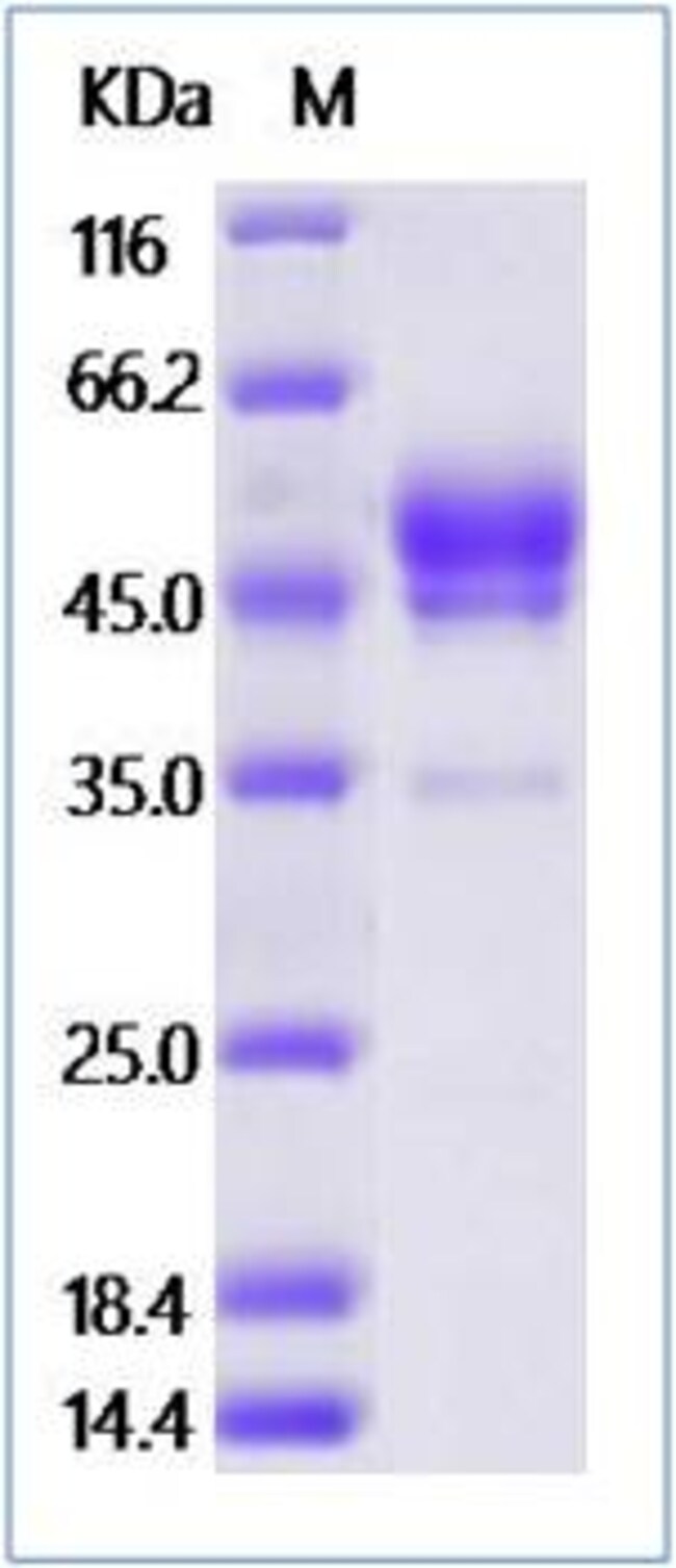 Sino Biological Rat TIGIT / VSTM3 Protein (Fc Tag) 100ug | Fisher ...