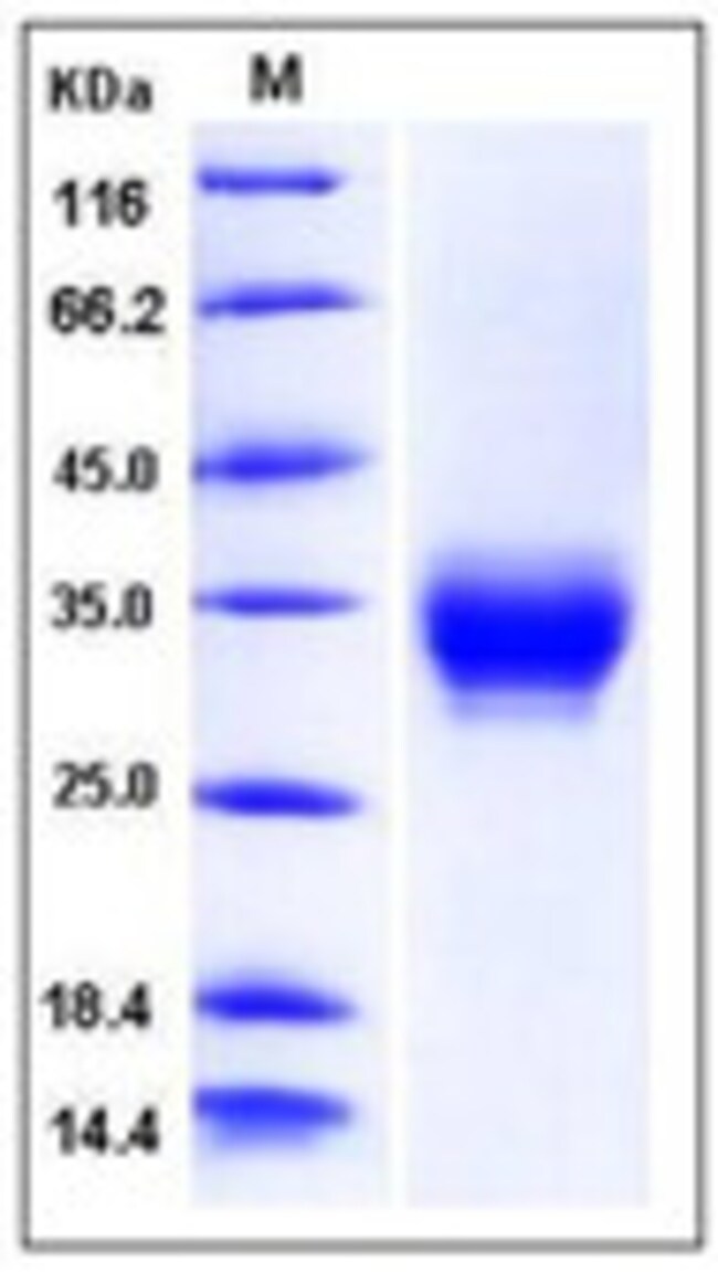 Sino Biological CD32A Protein, Cynomolgus, Recombinant (His & AVI Tag ...