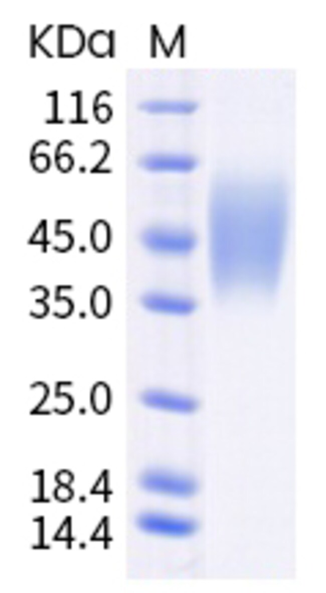 Sino Biological Cynomolgus CD226 Protein (His Tag) 100 g | Fisher ...