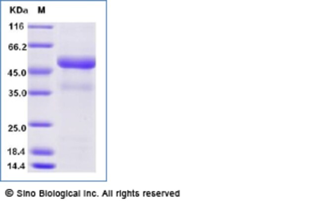 Sino Biological Cynomolgus 4-1BBL / CD137L Protein (Fc Tag ...