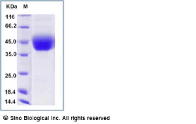 Sino Biological Cynomolgus IL-4R / CD124 Protein (His Tag) 100ug ...