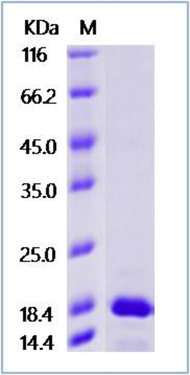 Sino Biological Cynomolgus IL11 Protein 10ug, Quantity: Each of 1 | Fisher Scientific