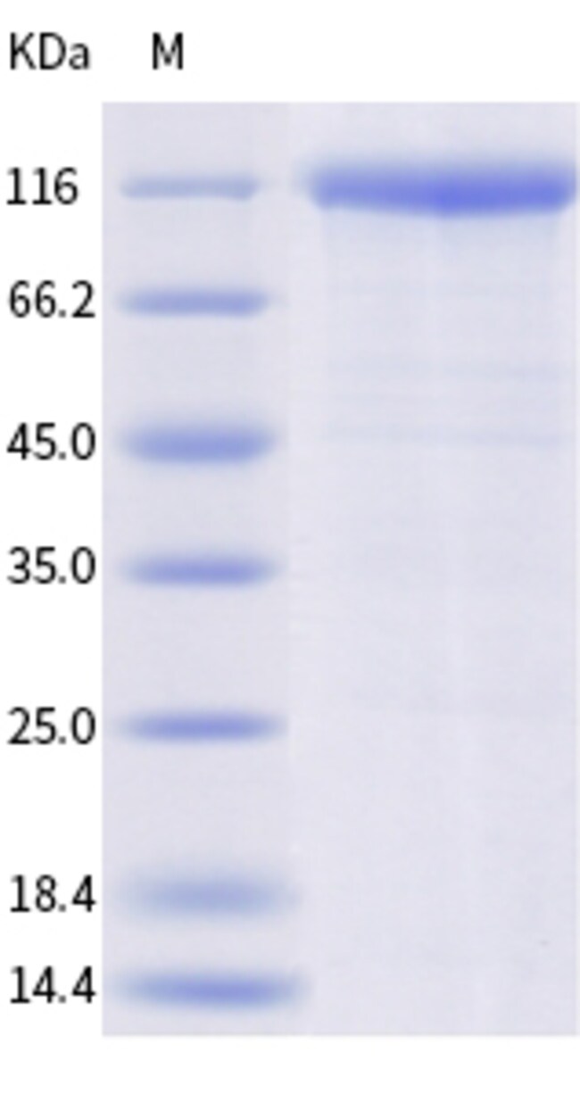 Sino Biological Cynomolgus IL12RB2 Protein (mFc Tag) 100ug | Fisher ...