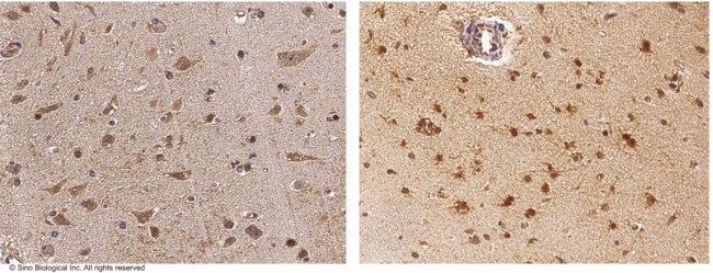 Sino Biological NGF / NGFB Antibody, Rabbit MAb 50uL, Quantity: Each of ...