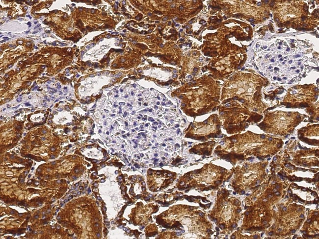 Sino Biological Carbonic Anhydrase IV / CA4 Antibody, Rabbit MAb 100µL ...