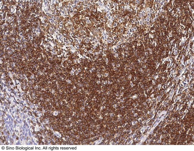 Sino Biological CD22/Siglec-2 Antibody, Rabbit PAb, Antigen Affinity ...