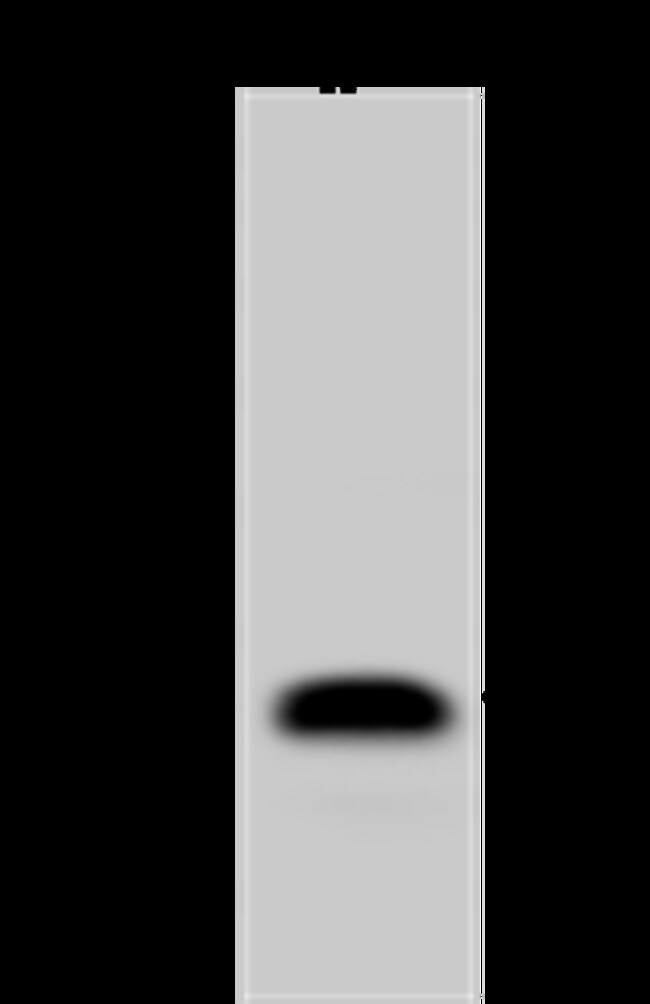 Sino Biological CD3 epsilon / CD3e Antibody, Mouse MAb 200uL | Fisher ...
