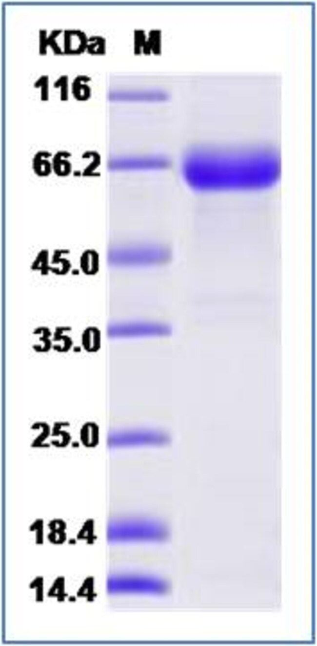 Sino Biological Human IL-23 (IL12B & IL23A Heterodimer) Protein (His ...