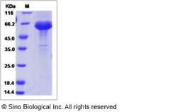Sino Biological Human IL-23 (IL12B & IL23A Heterodimer) Protein (His Tag) | Fisher Scientific