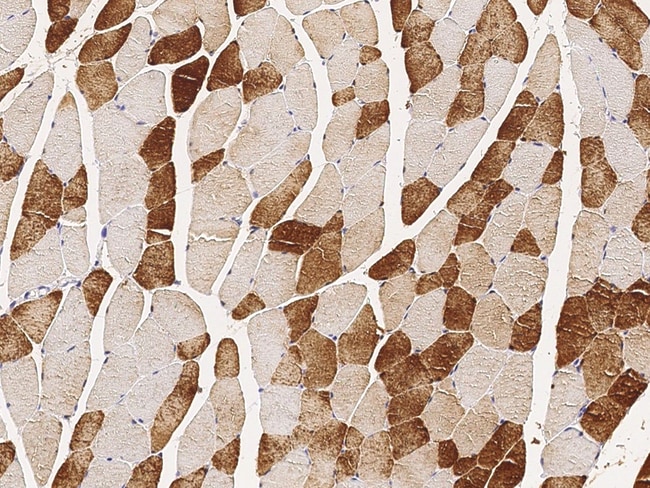 Sino Biological ENO3 / beta-enolase Antibody, Mouse Mab 200µL, Quantity ...
