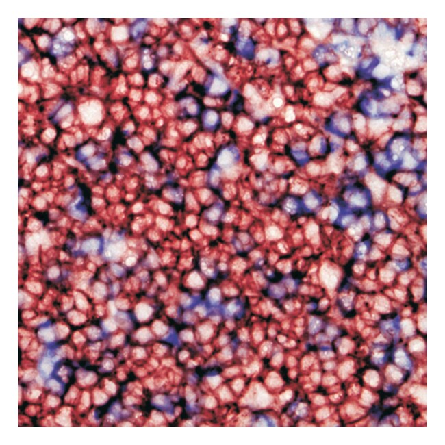 Epredia™ Lab Vision™ CD4/CD8 MultiVision Antibody Cocktail 7mL; Ready ...