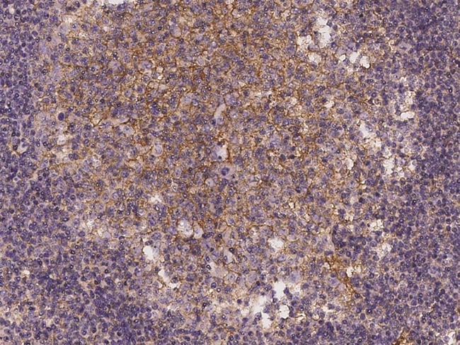 Sino Biological JAM-A/Junctional Adhesion Molecule A/F11R Antibody ...