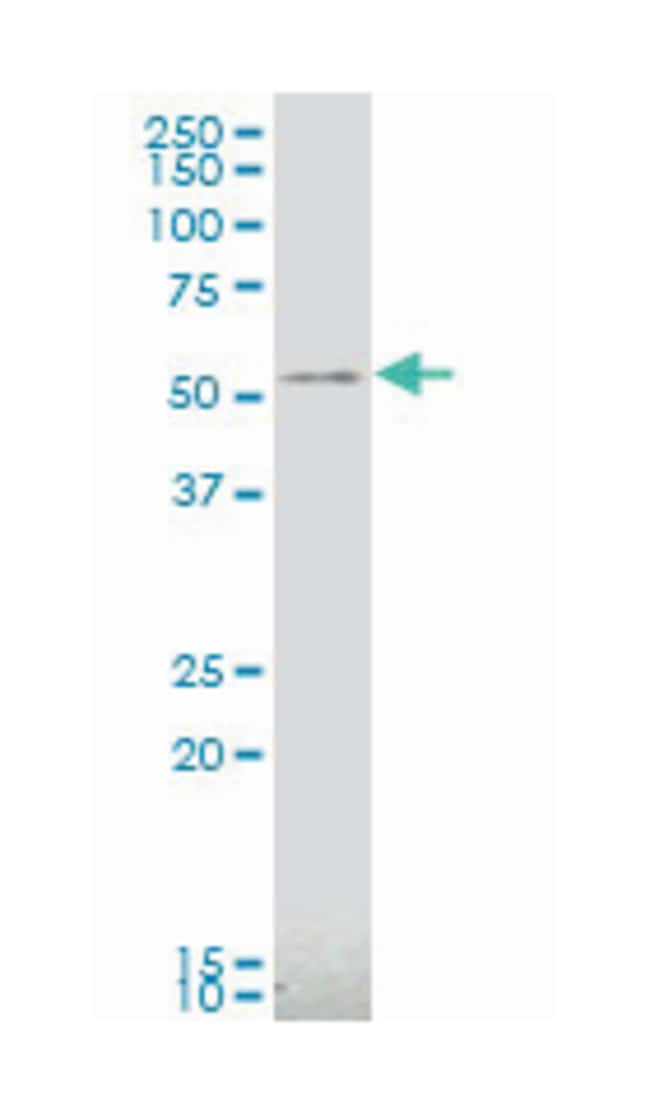 calcium/calmodulin-dependent protein kinase II alpha, Mouse, Clone: 2C12, Abnova™ 100μg ...