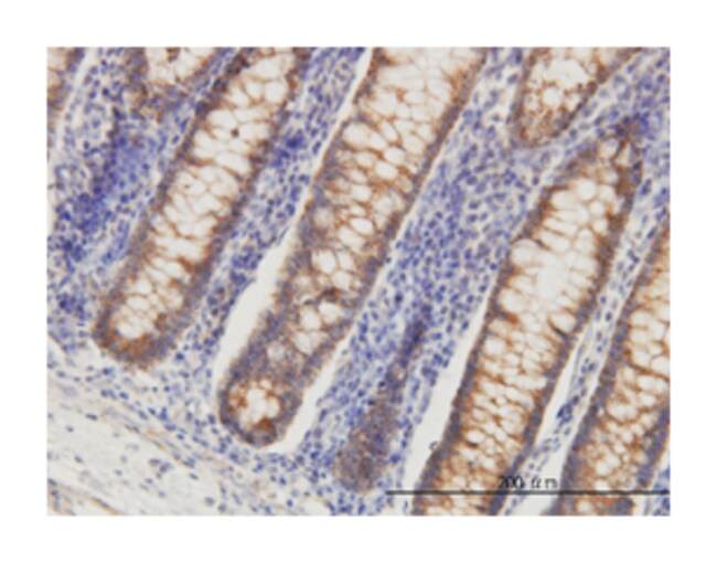 hydroxyacyl-Coenzyme A dehydrogenase, Mouse, Clone: 4B5, Abnova 100μg ...
