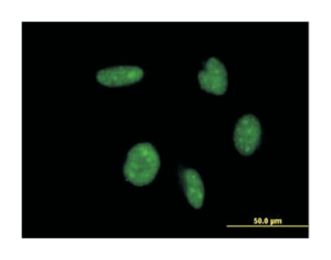 ANTI-ATOH1 (4H2) 100UG