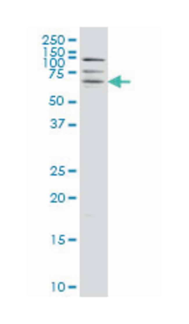 ANTI-CAMK2B (S11) 100UG