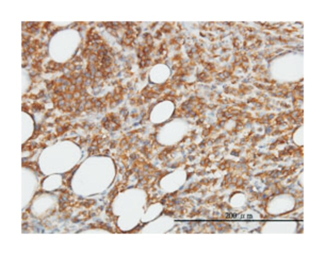 ANTI-CAMK2B (S11) 100UG