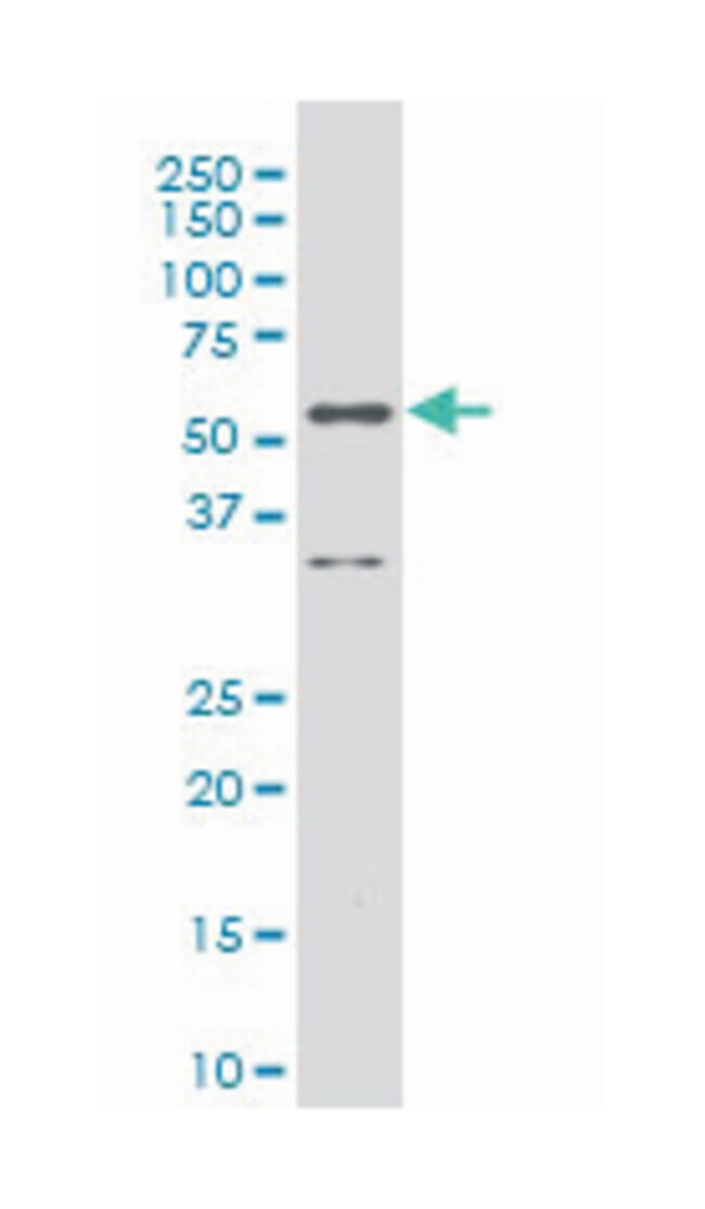 RUNX2, Mouse, Clone: 4E5, Abnova 200μg; Unlabeled:Anticuerpos | Fisher ...