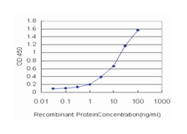 ANTI-CAMK2B (S11) 100UG