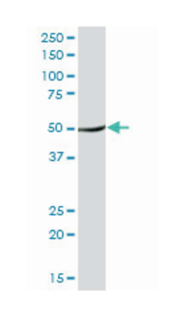ANTI-TUFM MAXPAB 50UG