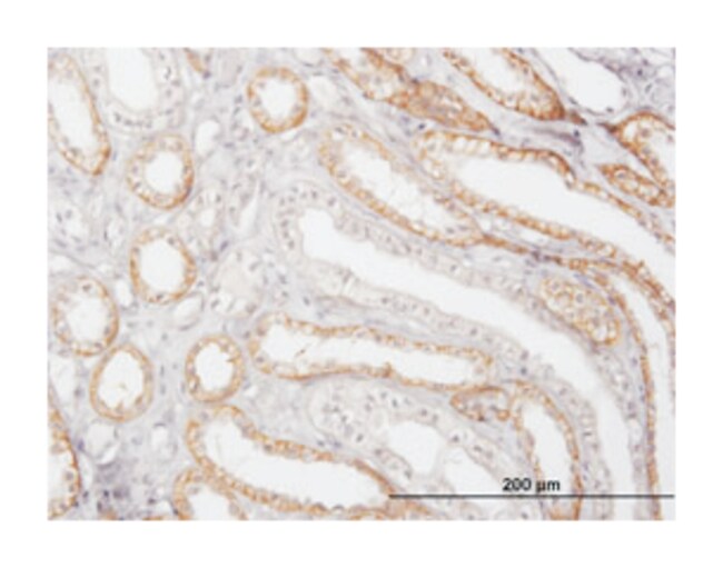 cathepsin K, Mouse, Clone: 2F1, Abnova 100μg; Unlabeled:Anticuerpos ...